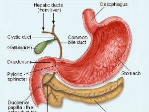 अब बच्चों में भी पित्त की पथरी के लक्षण | Gallbladder stones in ...