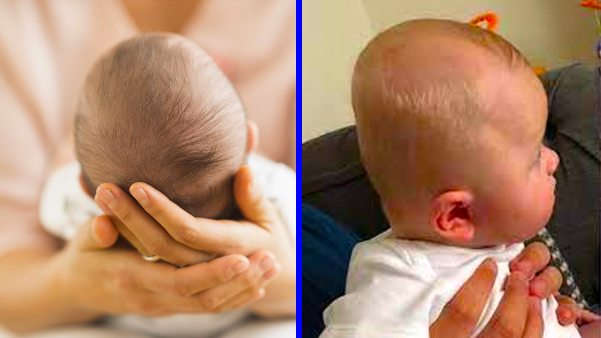 फ्लैट हैड सिंड्रोम: न्‍यूबोर्न बेबी को सुलाते वक्‍त न करें ये गलतियां, वरना सिर हो जाएगा एक तरफ ...