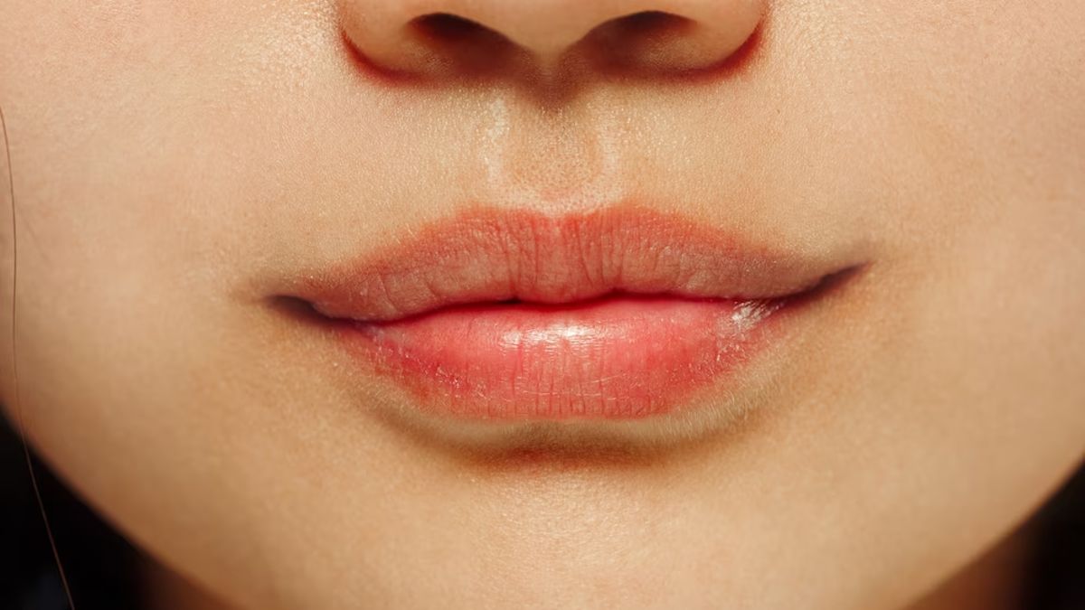 Skin care Tips : चिलचिलाती धूप में होंठ भी हो जाते हैं सनबर्न, यहां ...