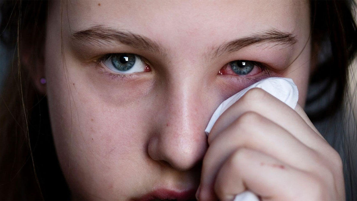 Eye Flu in Delhi: दिल्‍ली में बाढ़ के बाद बढ़ा Eye Flu का प्रकोप, जानें ...