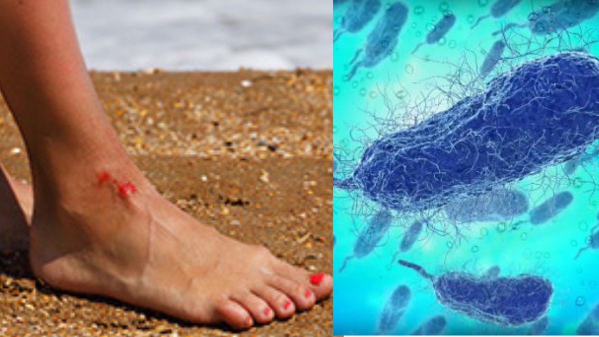 Vibrio Vulnificus: समुद्री फूड खाने वाले रहें बचके! इनमें मौजूद इंसानी ...