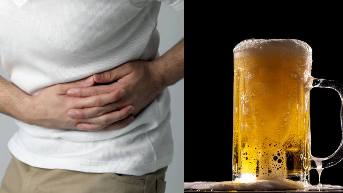 Myth Or Fact: क्या बियर पीने से निकल जाती है किडनी की पथरी ? जानें इससे ...