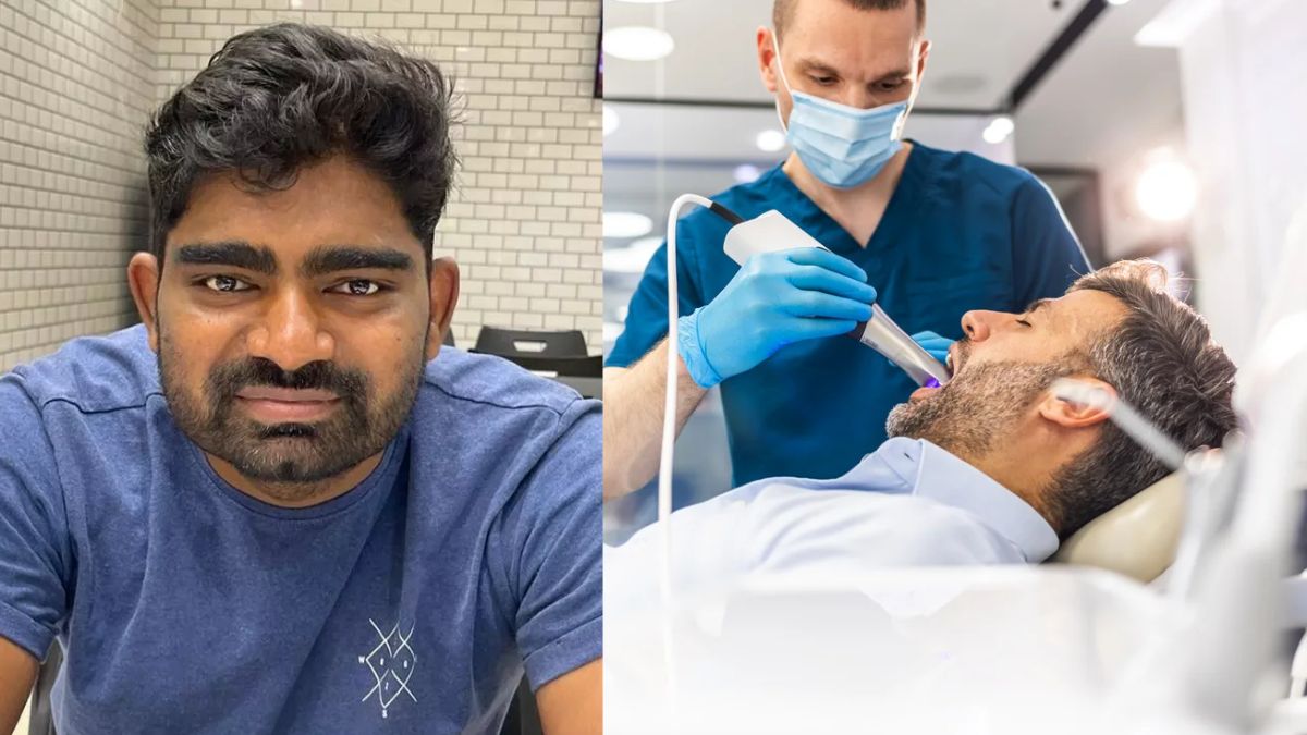 शादी से पहले दूल्हे ने कराई स्‍माइल डिजाइन‍िंग सर्जरी, चली गई जान, क् ...