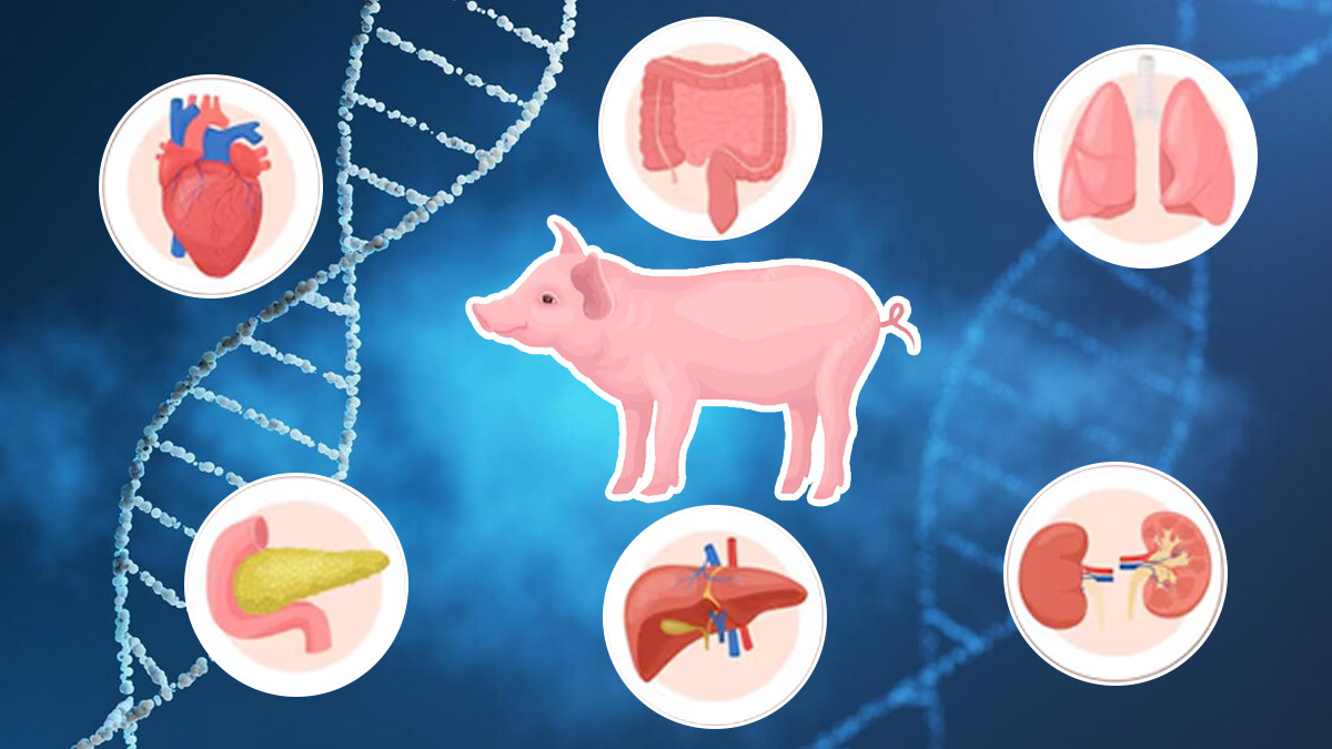 सुअर की किडनी ट्रांसप्लांट करवाने वाले पहले इंसान की मौत, कितना ...