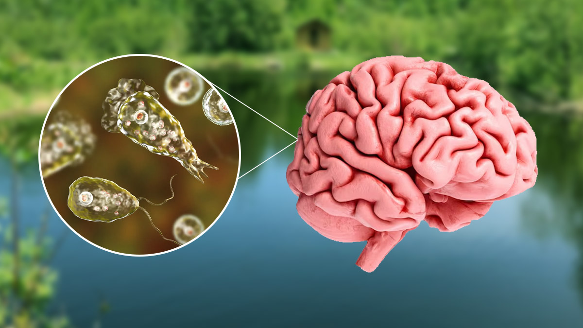 Brain-Eating Amoeba से केरल में बच्‍चे की मौत, 2 महीने में 3 मामला, एक ...